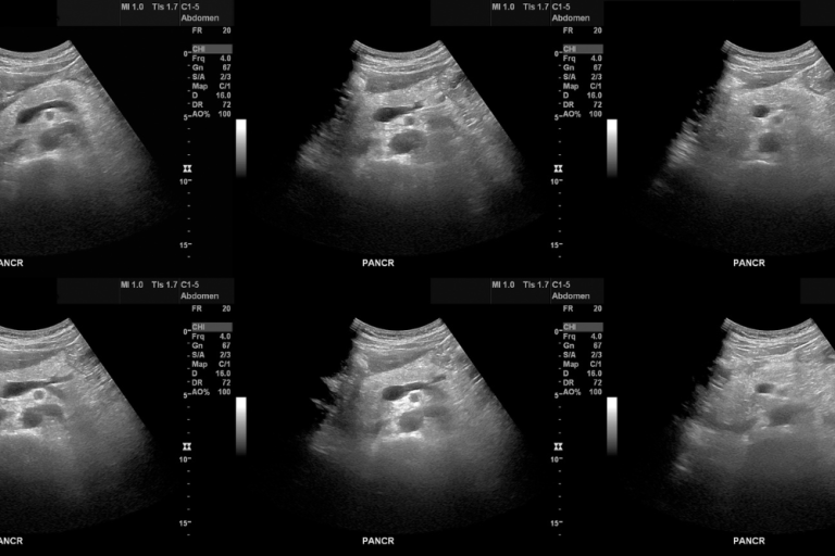 Ultrasonido de Tejidos Blandos en Mérida | CMA Hospital
