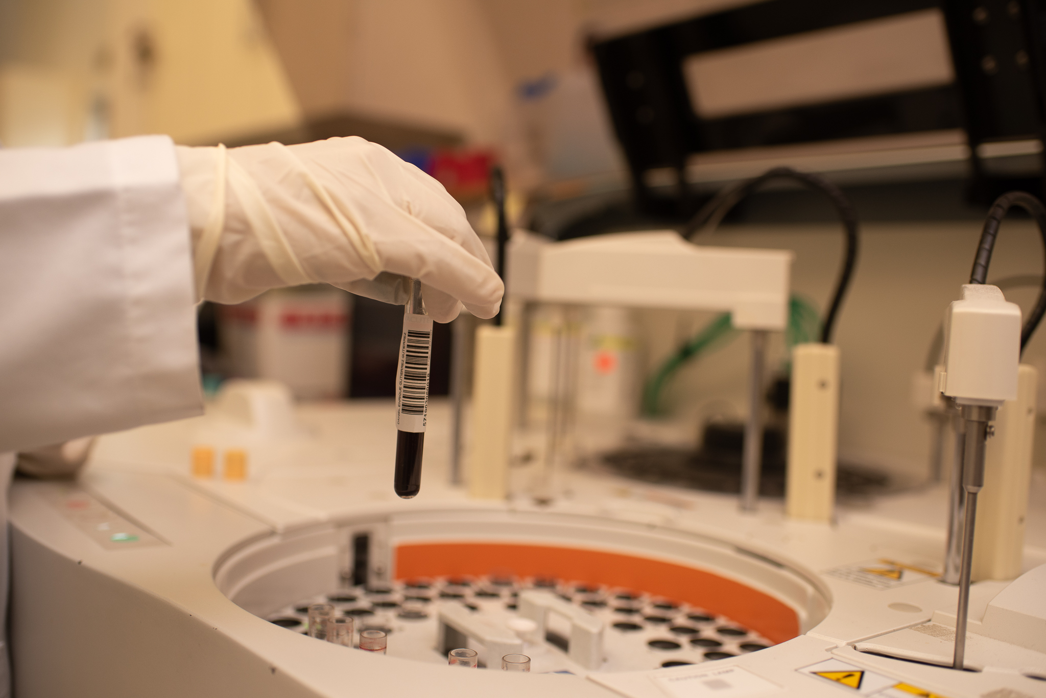 Exámenes hormonales de laboratorio en Mérida | CMA Hospital