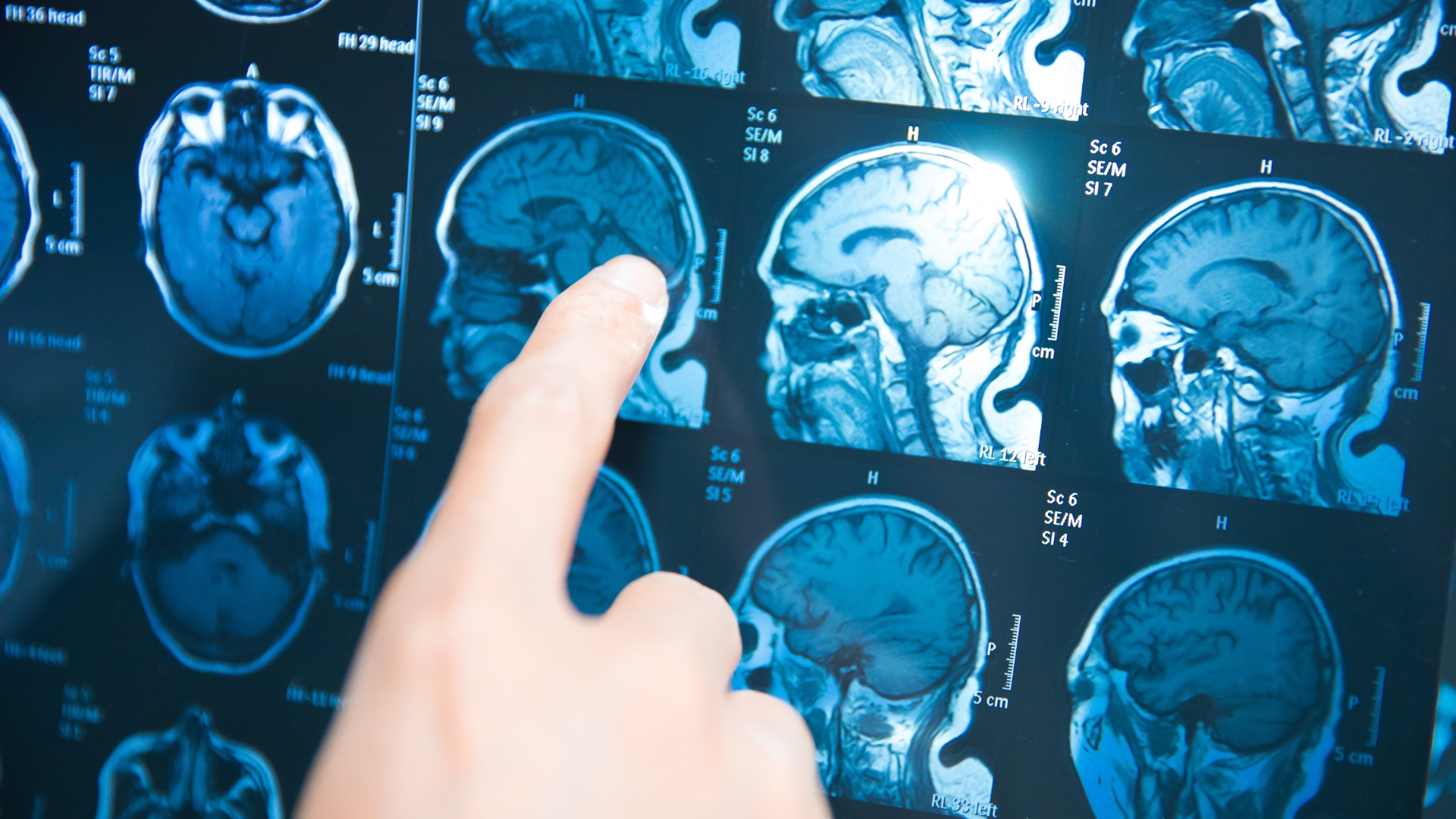 Resonancia magnética de oído en Mérida | CMA Hospital